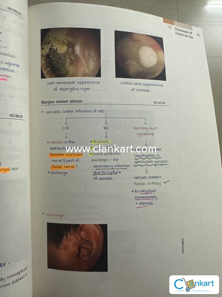 Buy 'ENT (M4)-Marrow Transcript-Based Notes (from Video Lectures)' Book ...