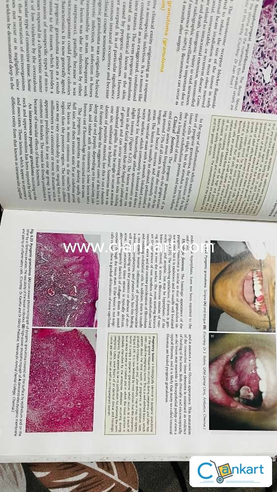 Buy 'Shafer's Textbook Of Oral Pathology' Book In Excellent Condition ...